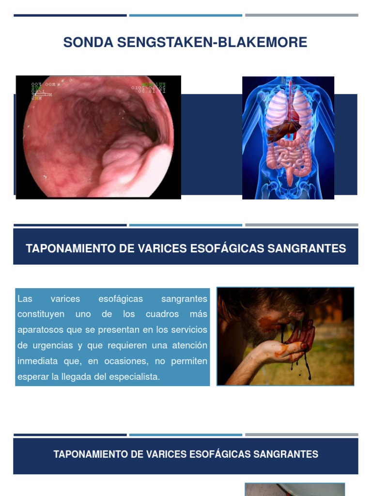 Sonda Sengstaken Blakemore | PDF | Medicina CLINICA | Especialidades ...