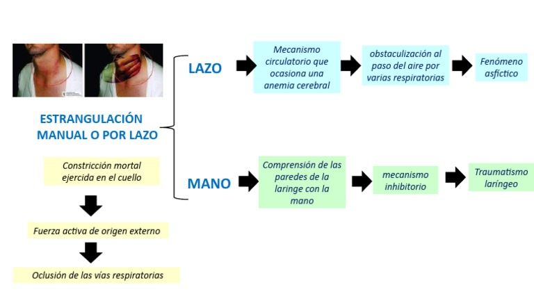 Estrangulación Manual o Por Lazo | PDF