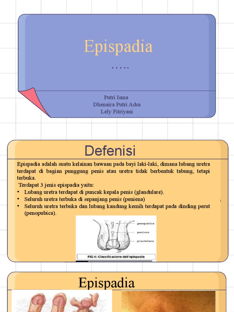 Epispadia | PDF