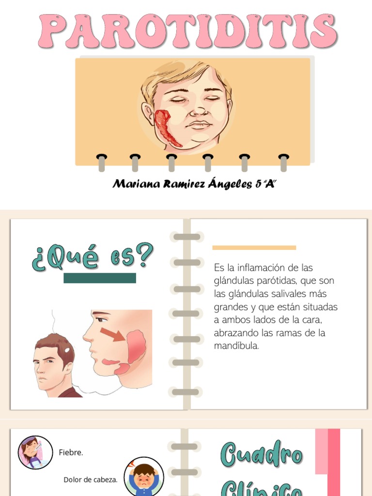 Parotiditis - Mariana Ramirez | PDF | Virología | Especialidades Medicas