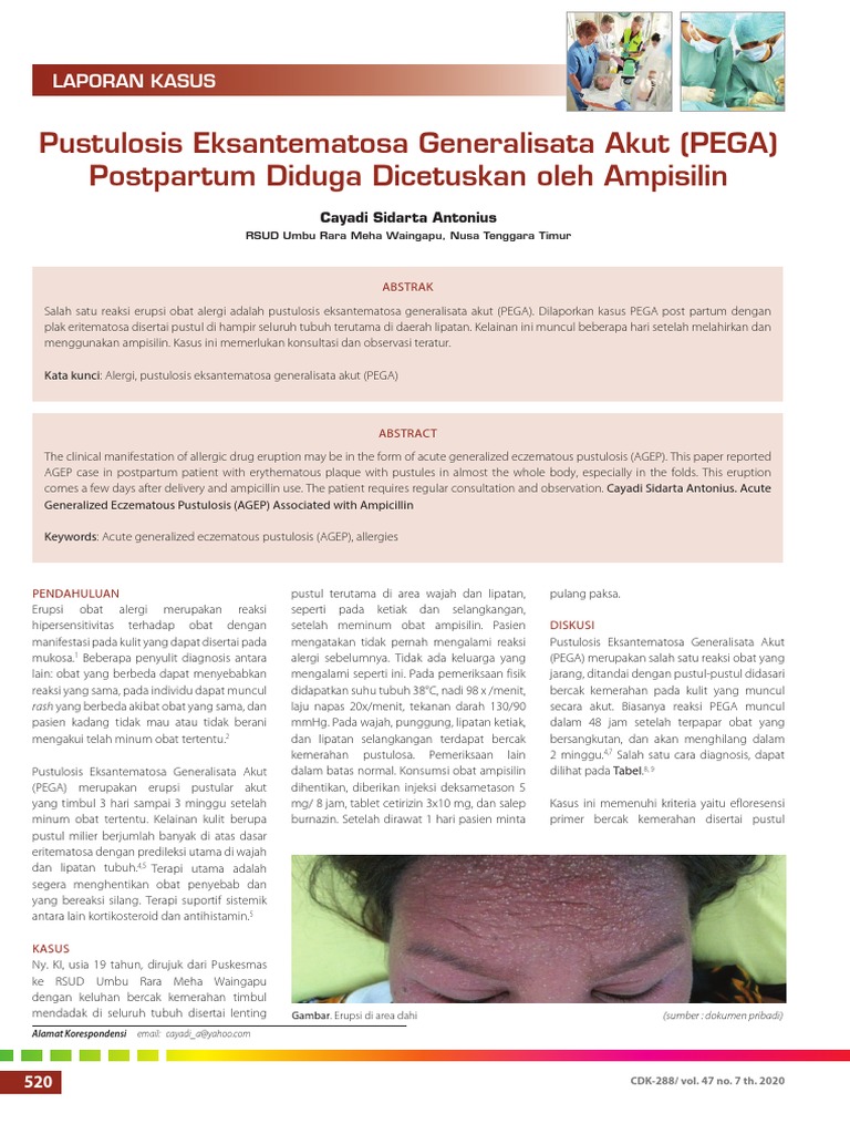 Pustulosis Eksantematosa Generalisata Akut (PEGA) Postpartum Diduga ...