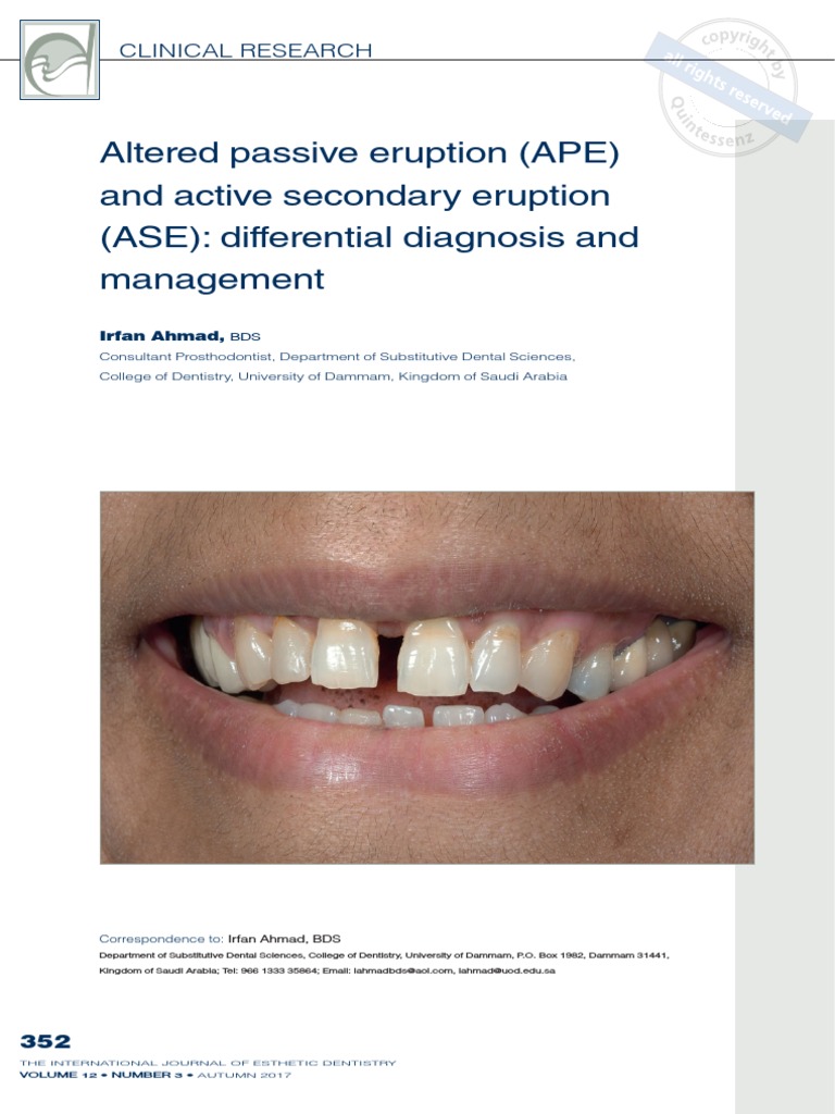 Altered Passive Eruption and Active Secondary Eruption | PDF ...