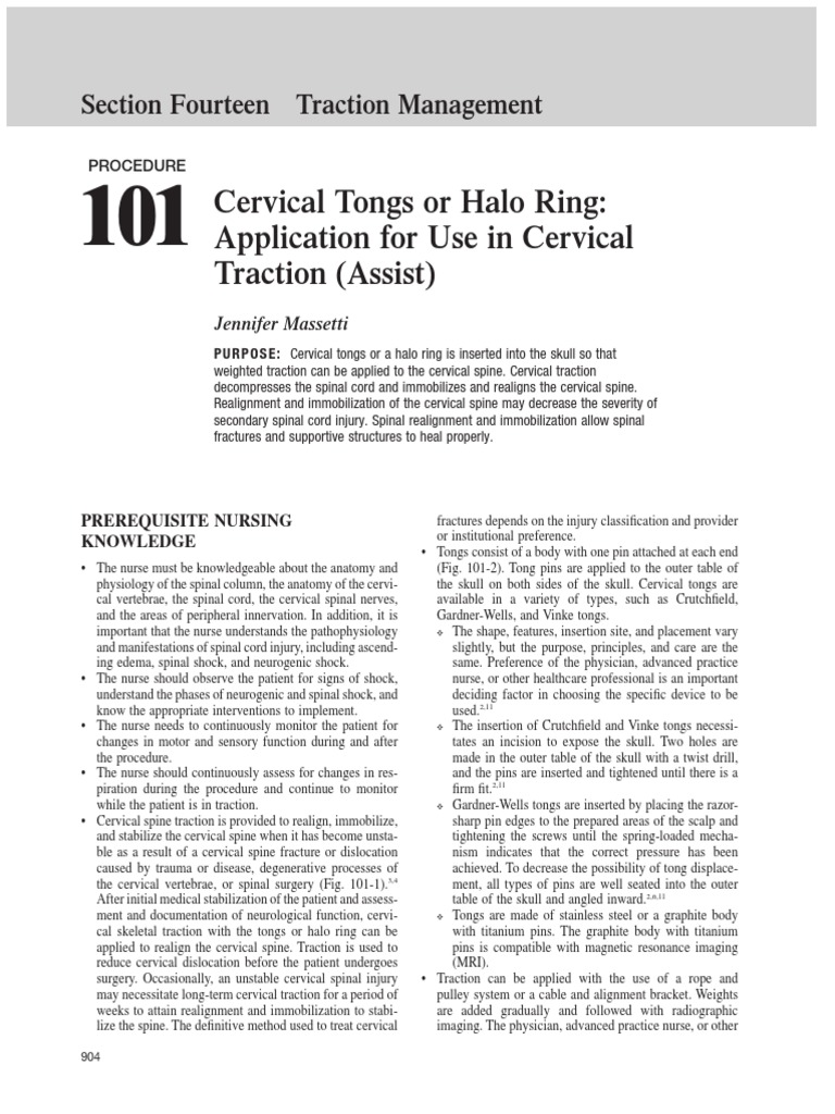 Cervical Tongs or Halo Ring: Application For Use in Cervical Traction ...