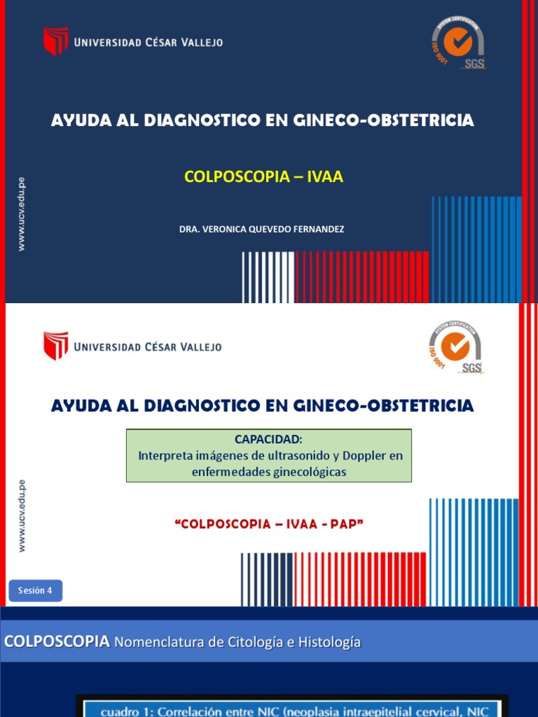 Colposcopía | PDF