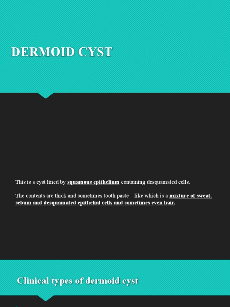 Dermoid Cyst | PDF | Human Nose | Clinical Medicine