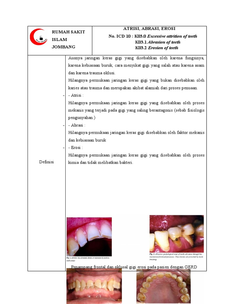 SPM ATRISI, ABRASI, EROSI | PDF