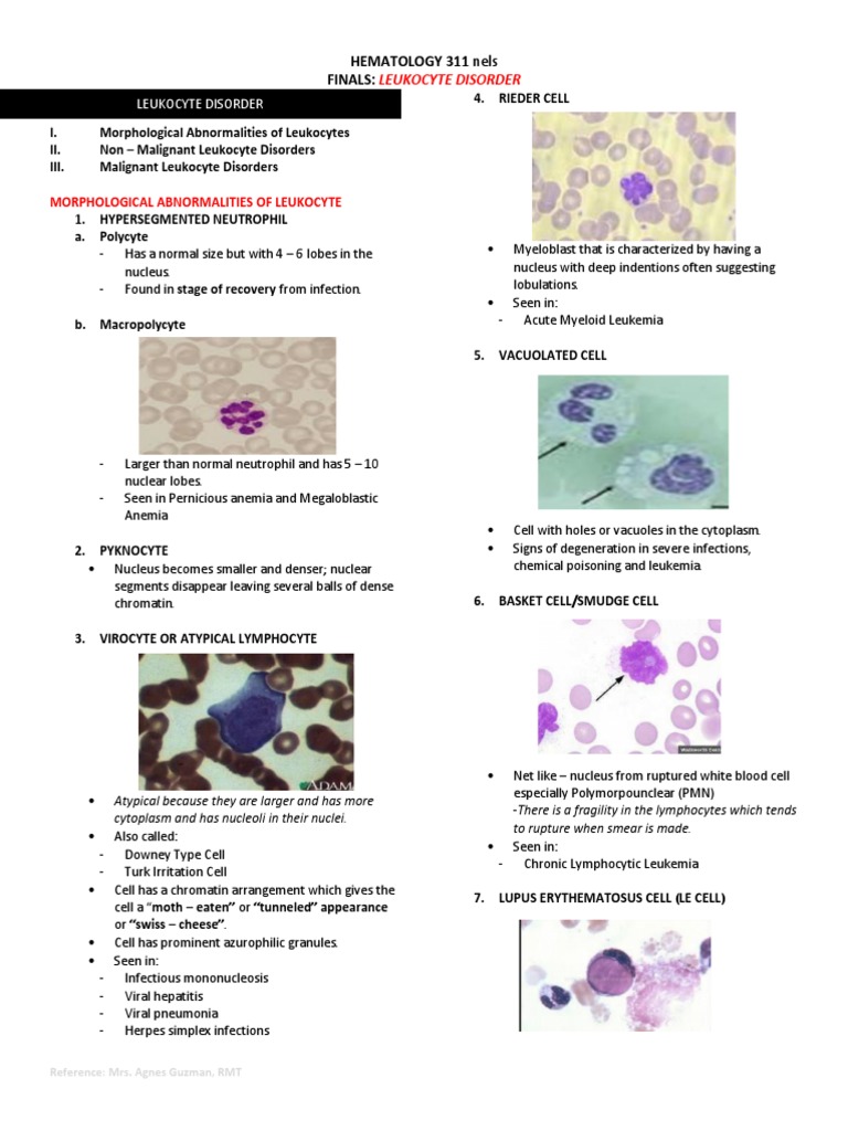 Finals Week 12-Leukocyte-Disorders | PDF | White Blood Cell | Granulocyte