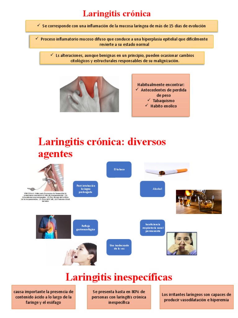 Laringitis Crónica: Causas y Tratamientos | PDF | Laringe | Tos