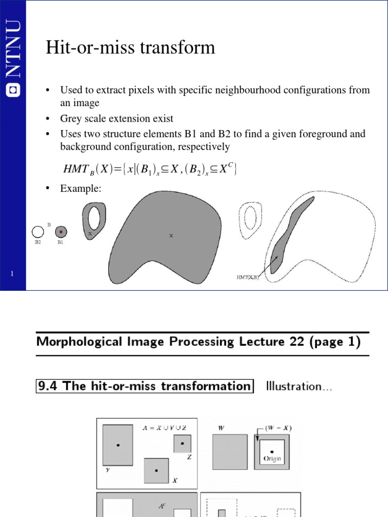 Hit-Or-Miss Transform: X (X B X, B X) | PDF | Liver | Surgery