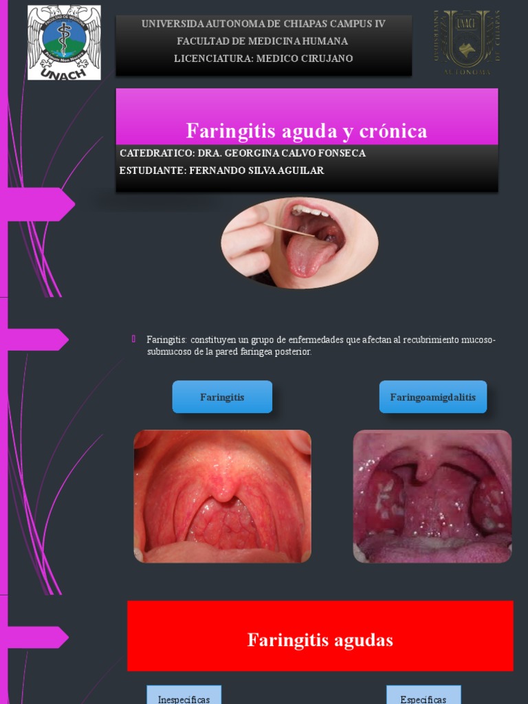 Faringits | PDF | Herpes Simple | Medicina