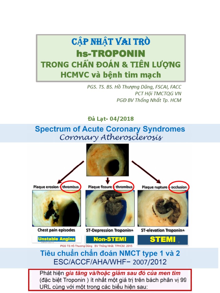 Cap Nhat Vai Tro HS Troponin HoThuongDung | PDF
