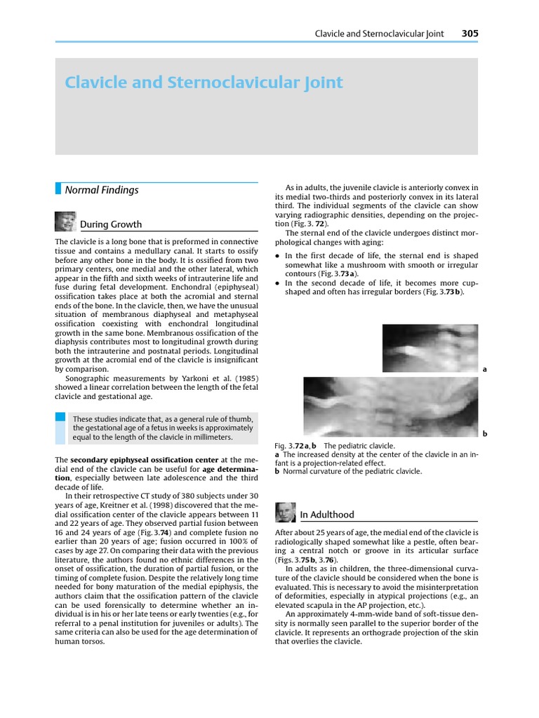 Clavicle and Sternoclavicular Joint | PDF | Clinical Medicine | Anatomy
