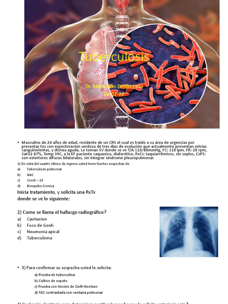 Tuberculosis Examen | PDF | Tuberculosis | Sistema inmune