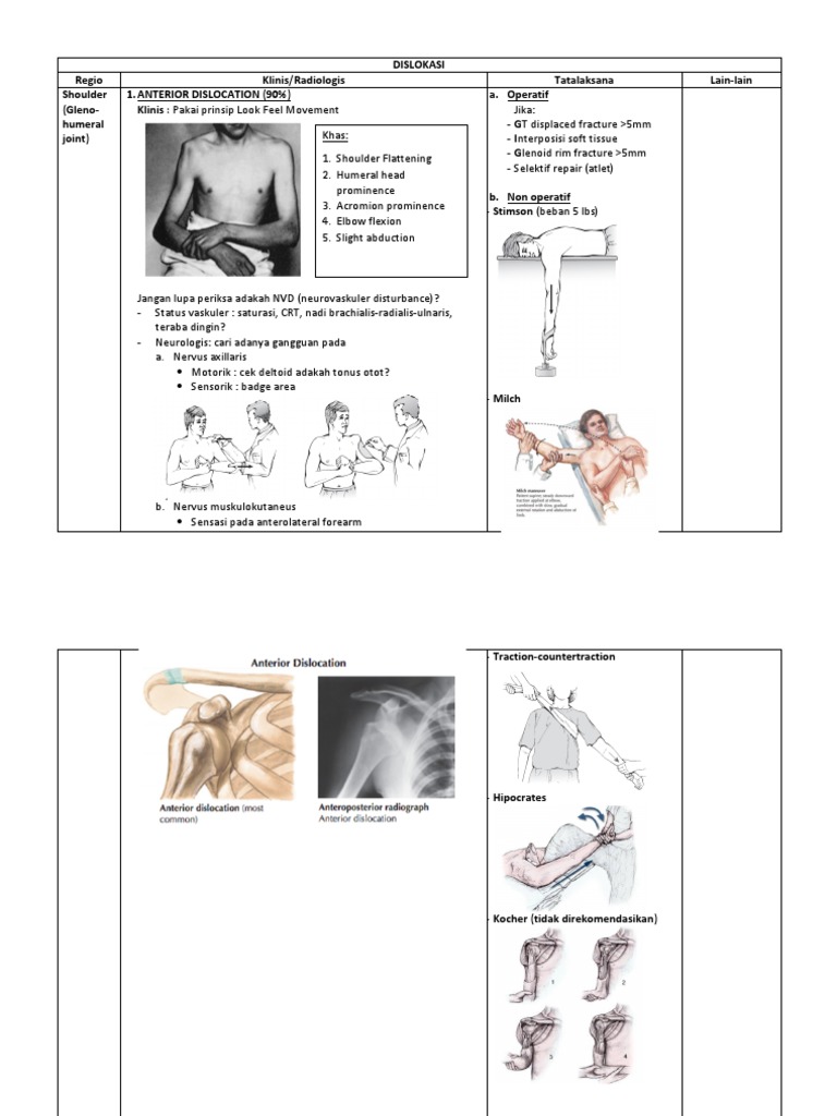 Kocher Techniques for Shoulder Dislocation | PDF | Shoulder | Human Anatomy