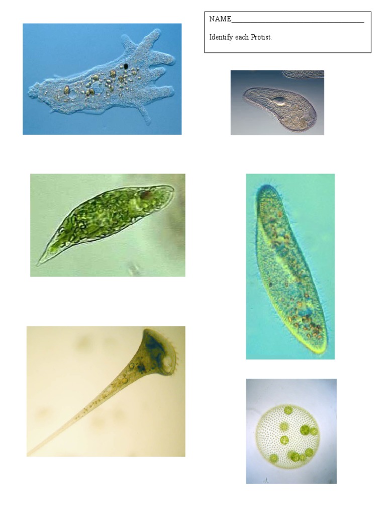 Protist Packet | PDF | Protozoa | Cell (Biology)