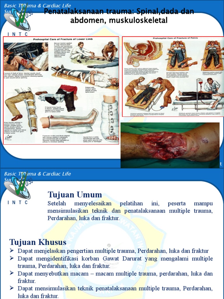 BTCLS Luka Dan Fraktur | PDF