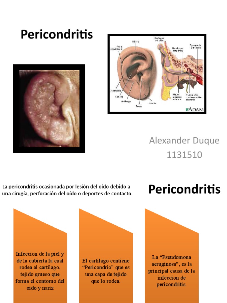 Pericondritis - Oido Externo Patologia