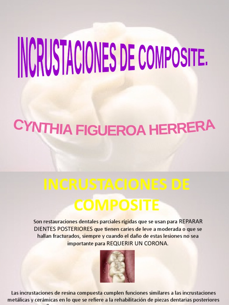 Incrustaciones de Composite | PDF | Odontología | Compuesto Dental