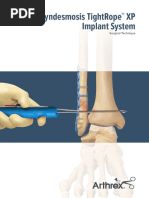 Arthrex FiberTag TightRope Implant | PDF | Surgical Suture | Surgical ...