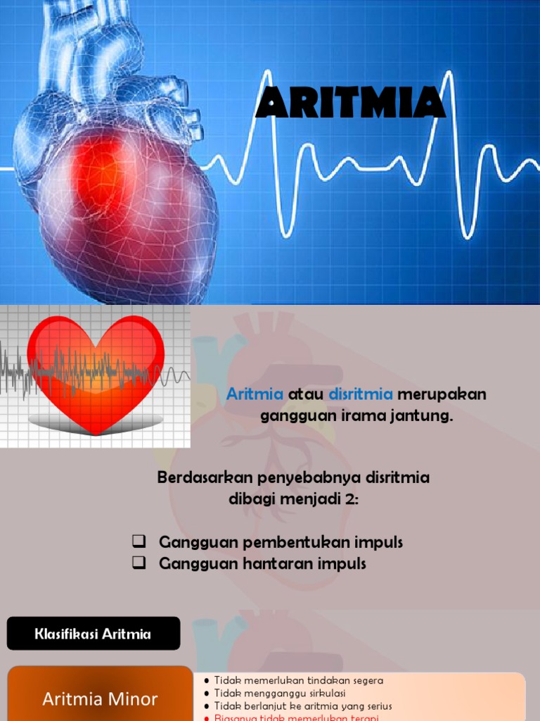 Aritmia Gangguan Pembentukan Impuls | PDF