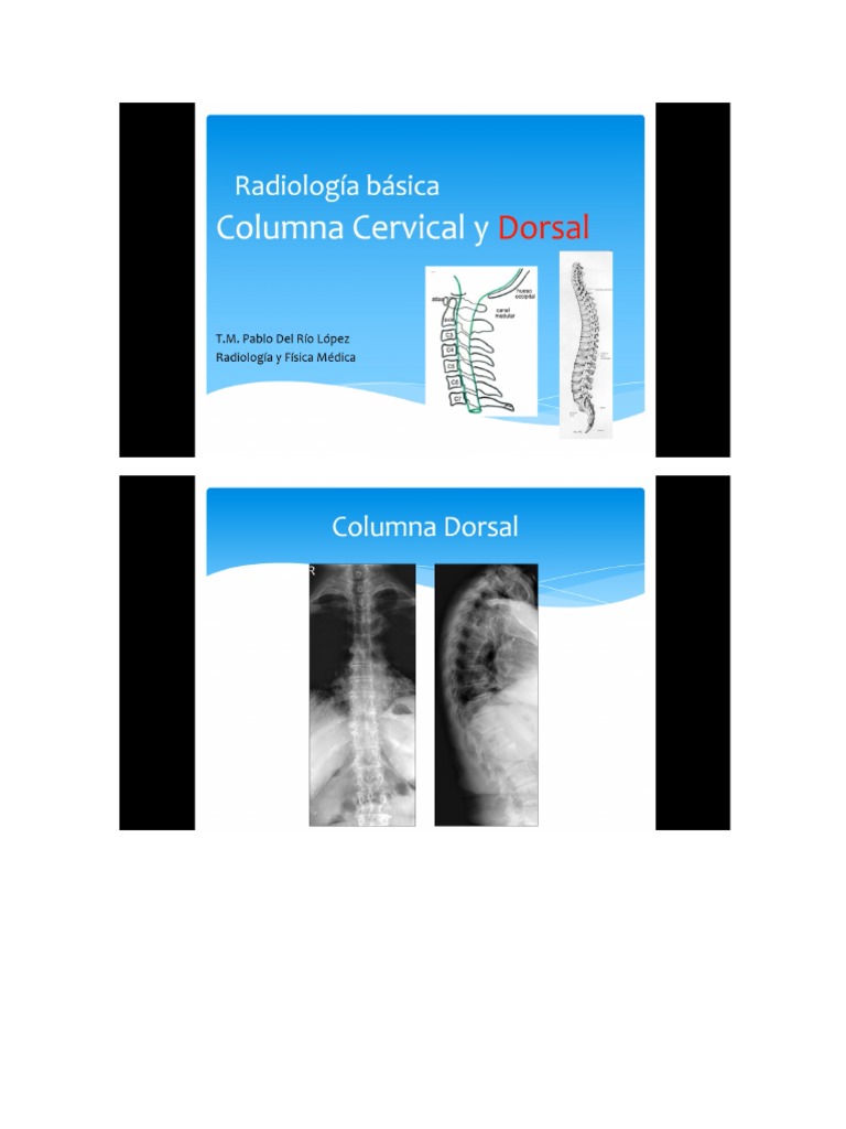 Columna Dorsal, Protocolo de RX | PDF | La columna vertebral | Sistema musculoesquelético