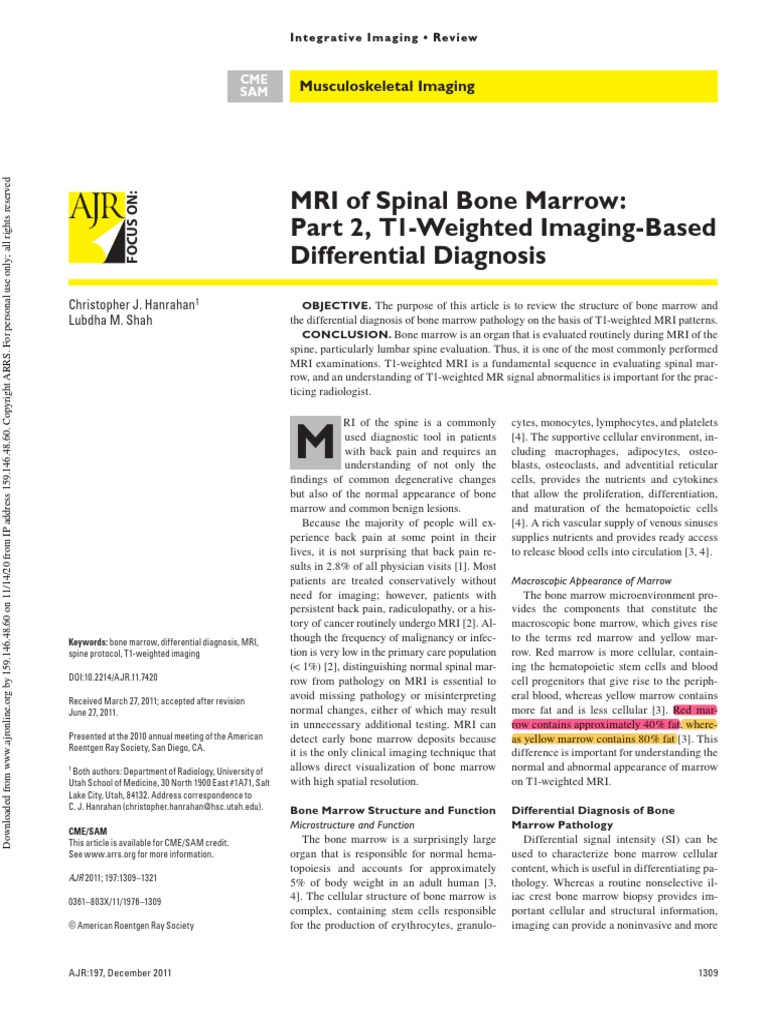 MRI of Spinal Bone Marrow Part 2 T1-Weighted Imaging-Based Differential ...