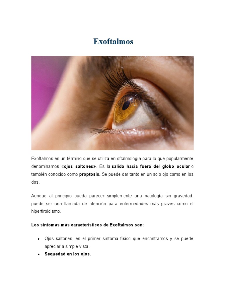 Exoftalmos | PDF