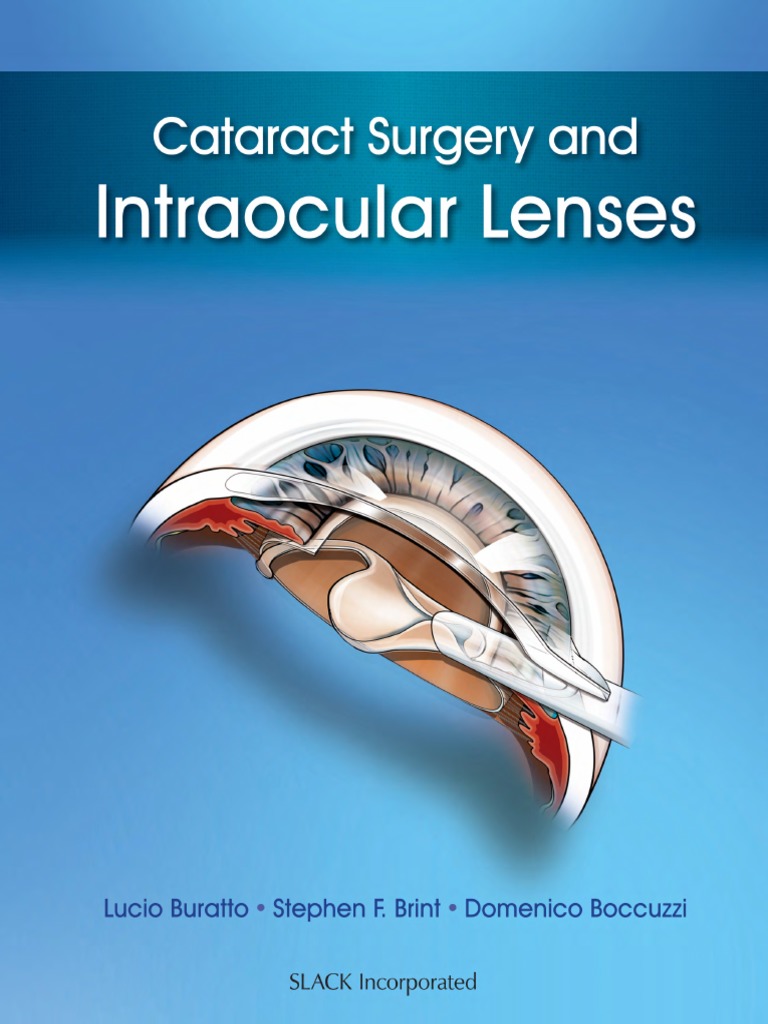 Cataract Surgery and Intraocular Lenses (2014) | PDF