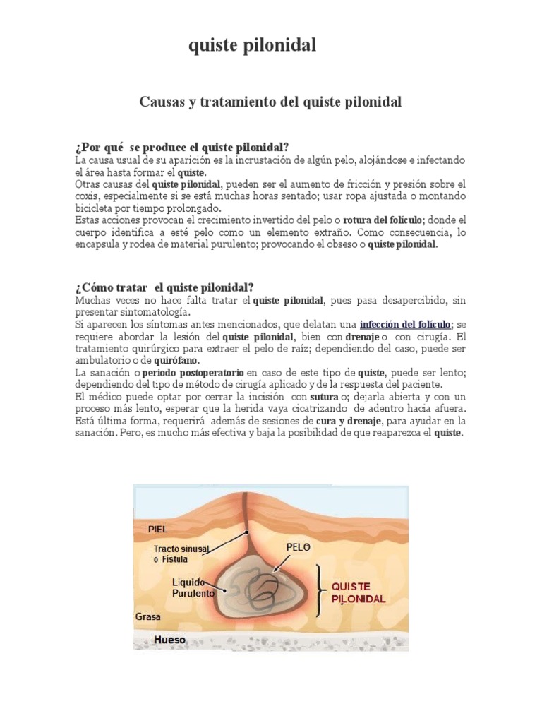 Quiste Pilonidal | PDF | Ciencia y matemáticas