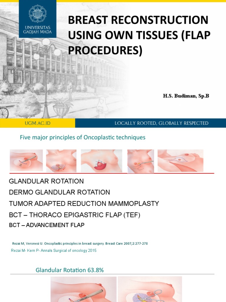 Breast Recosntruction Flap Procedure | Download Free PDF | Surgery ...