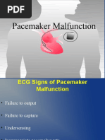Manual - ST Jude Pacemaker PM2140 | PDF | Artificial Cardiac Pacemaker ...