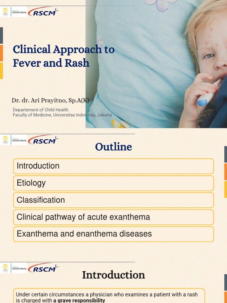 Clinical Approach to Fever with Rash | PDF | Infection | Measles