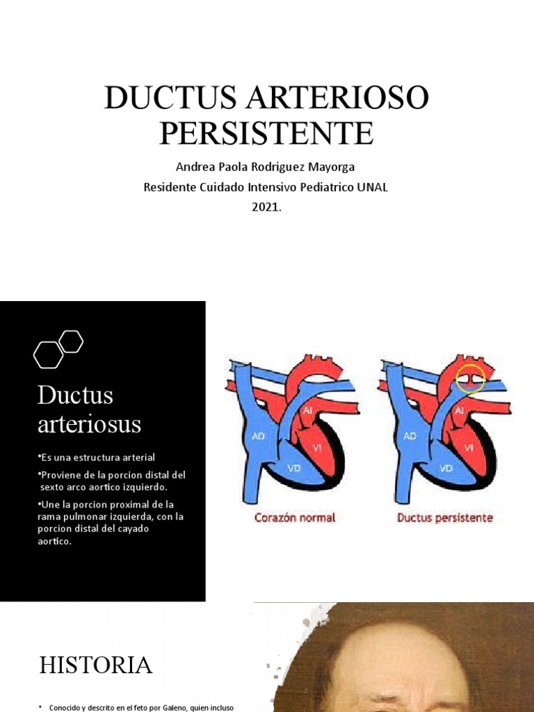 Ductus Arterioso Persistente | PDF