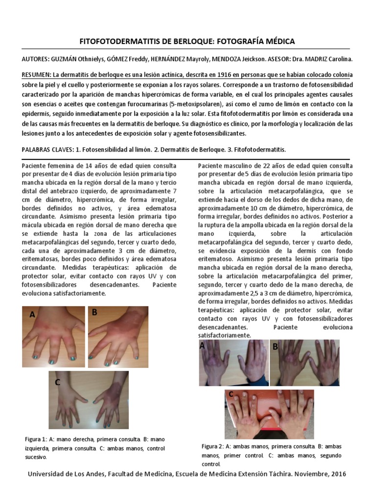 Resumen - Dermatitis de Berloque | PDF