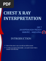 PA vs AP Chest Radiographs Explained | PDF | Radiography | Radiology