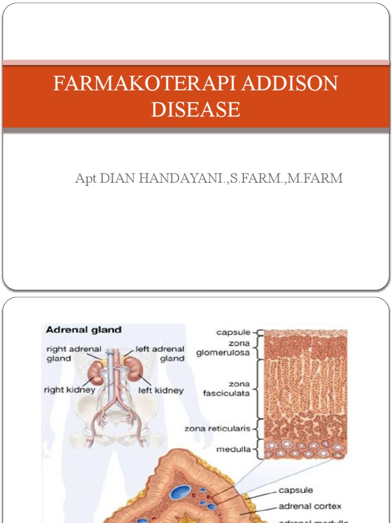 Farmakoterapi Addison Disease | PDF