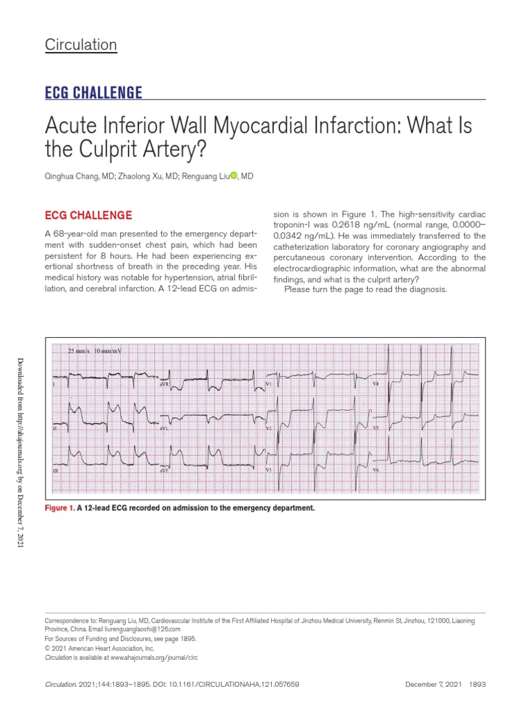 Acute Inferior Wall Myocardial Infarction: What Is The Culprit Artery ...