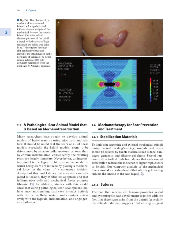 Textbook On Scar Management Teot 2021 39 | PDF | Scar | Diseases And ...