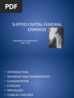Posterior Tibial Tendon Insufficiency (PTTI) - Foot & Ankle ...