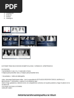 Interpretacion RX Torax Silueta Cardiaca V2 | PDF | Corazón | Pulmón