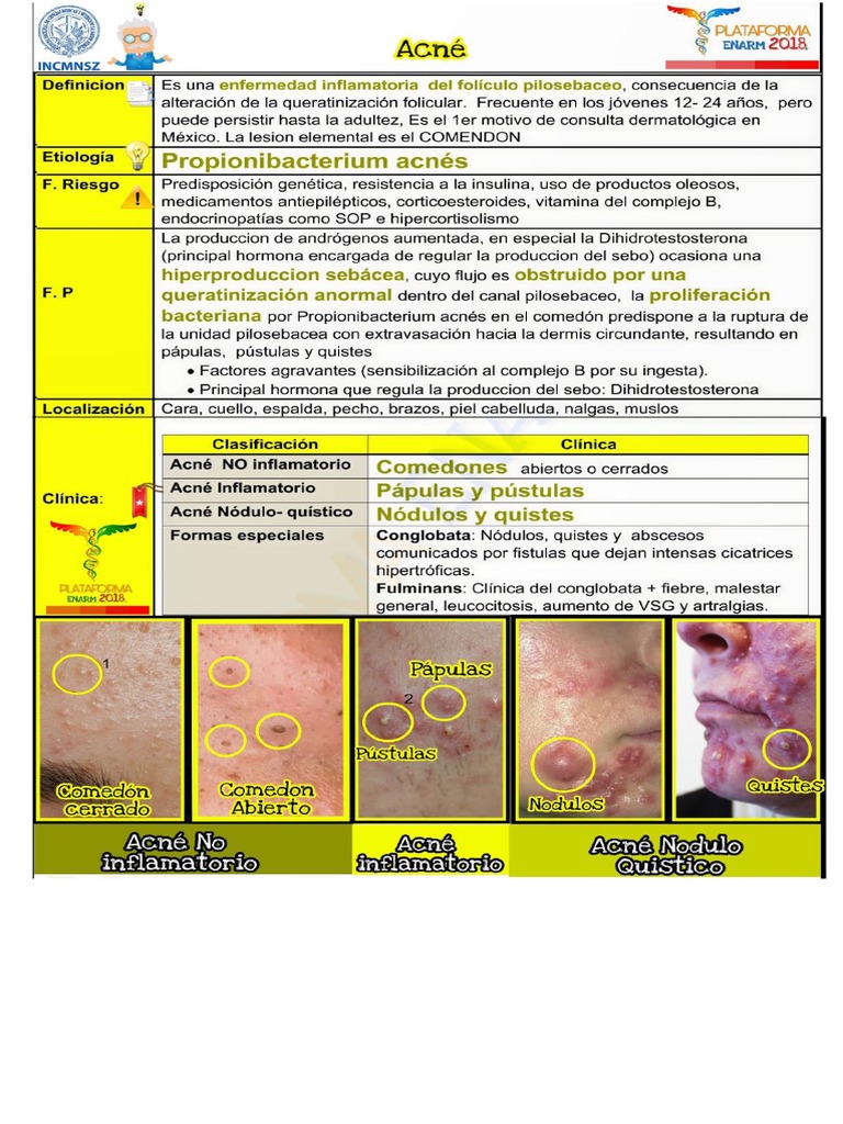 ACNE | PDF