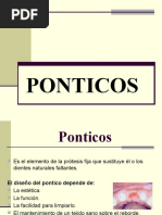 Consideración Del Diseño de Póntico para Una Prótesis Dental Fija ...