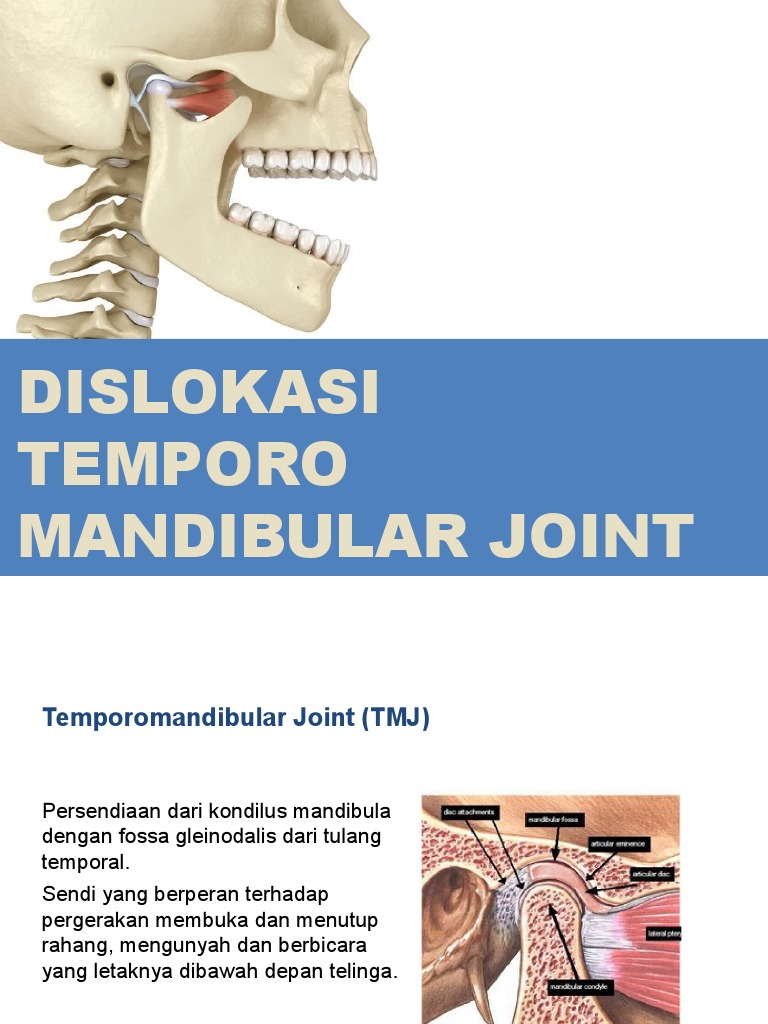 Dislok TMJ-1 | PDF