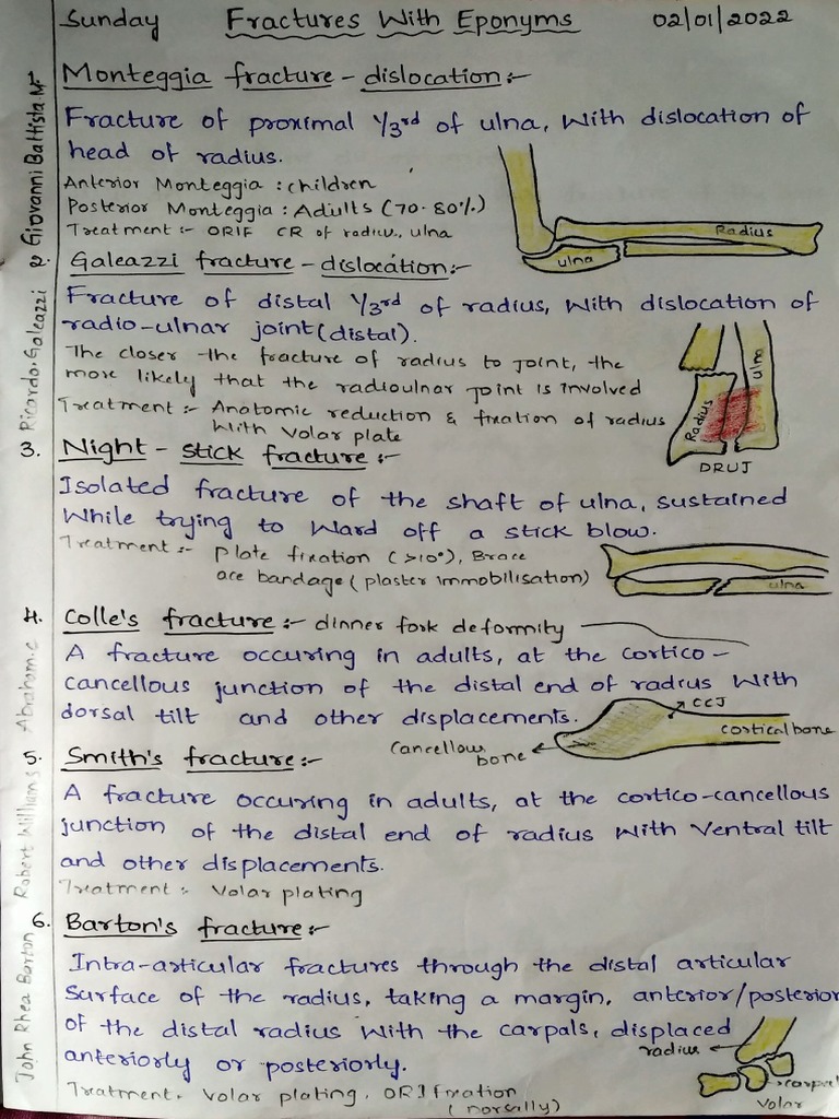 Fractures With Eponyms-Cl. Ortho | PDF | Lower Limb Anatomy | Human Anatomy