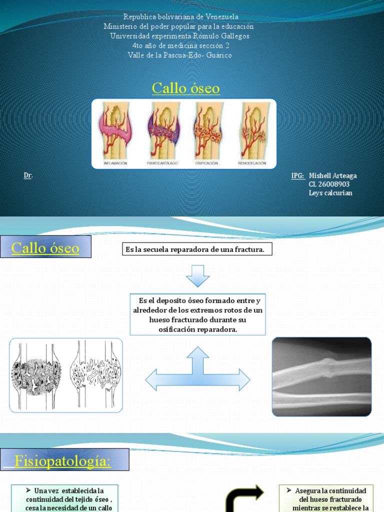 Traumatologia - Callo Oseo | PDF | Hueso | Especialidades Medicas