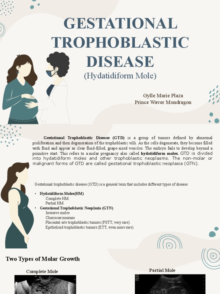 Gestational Trophoblastic Disease Symptoms – LMXF