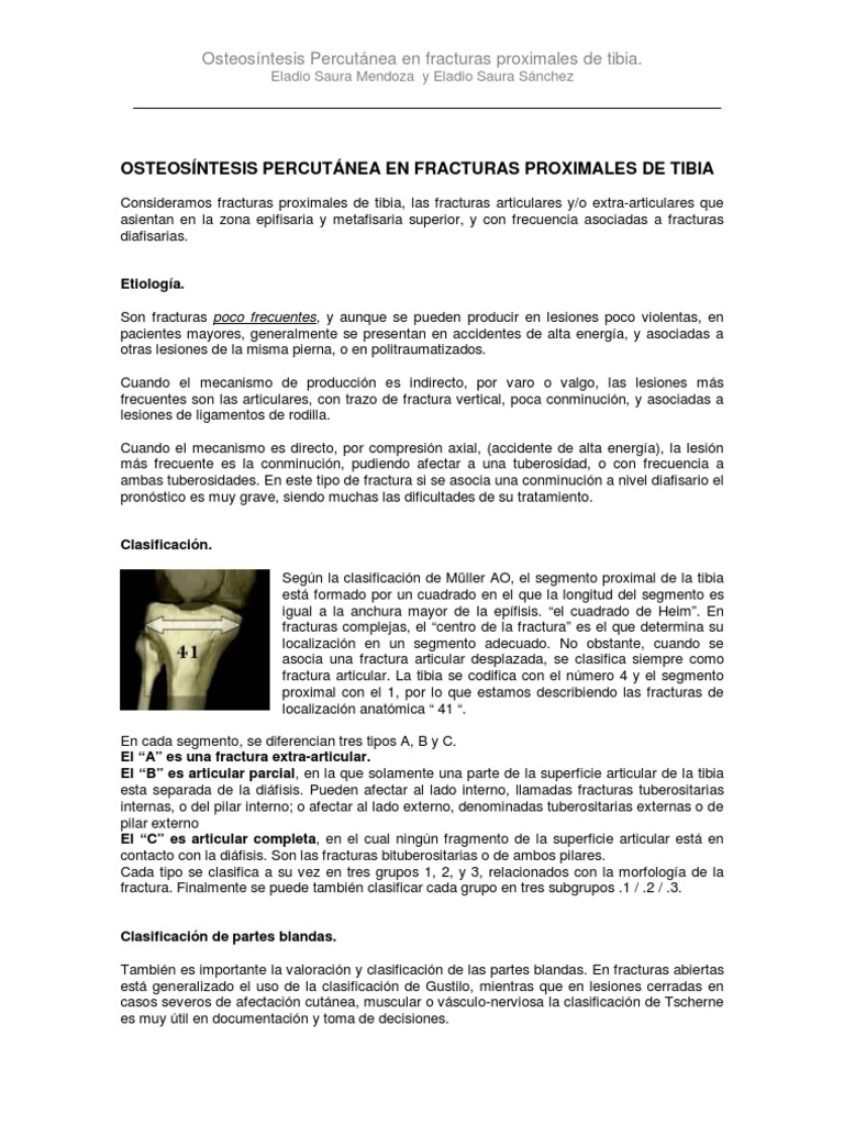Osteosíntesis Percutánea en Fracturas Proximales de Tibia. Eladio Saura ...