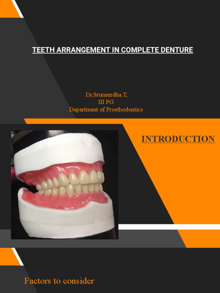 Principles of Teeth Arrangement in Dentures | PDF | Dentistry ...