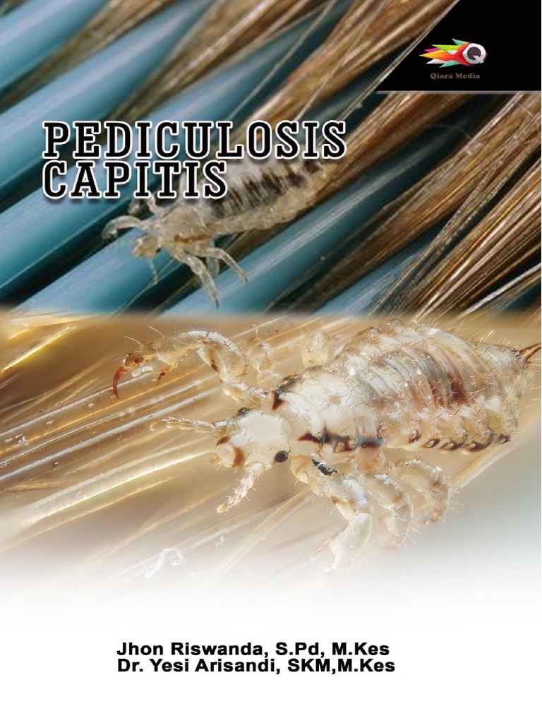 Pediculosis Capitis | PDF