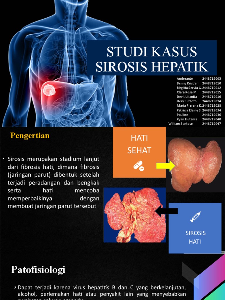 Studi Kasus SIROSIS HATI | PDF